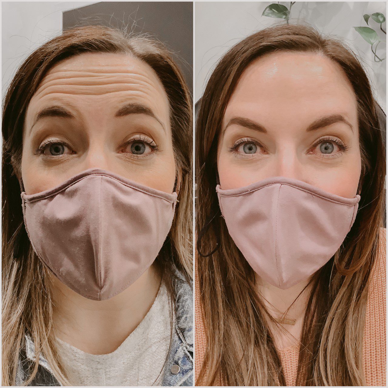 Botox & Fillers Nashville - Green Hills, Brentwood, Franklin TN