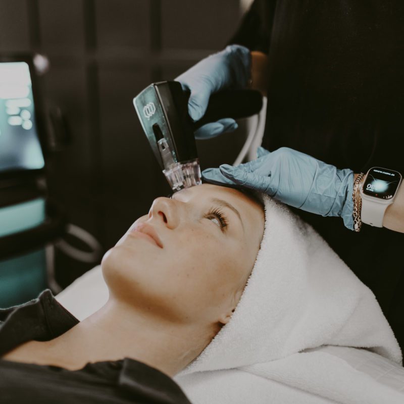 Post Treatment Guide For Morpheus8 - Elan Skin and Laser Post Treatment Guide For Morpheus8 - Elan Skin and Laser