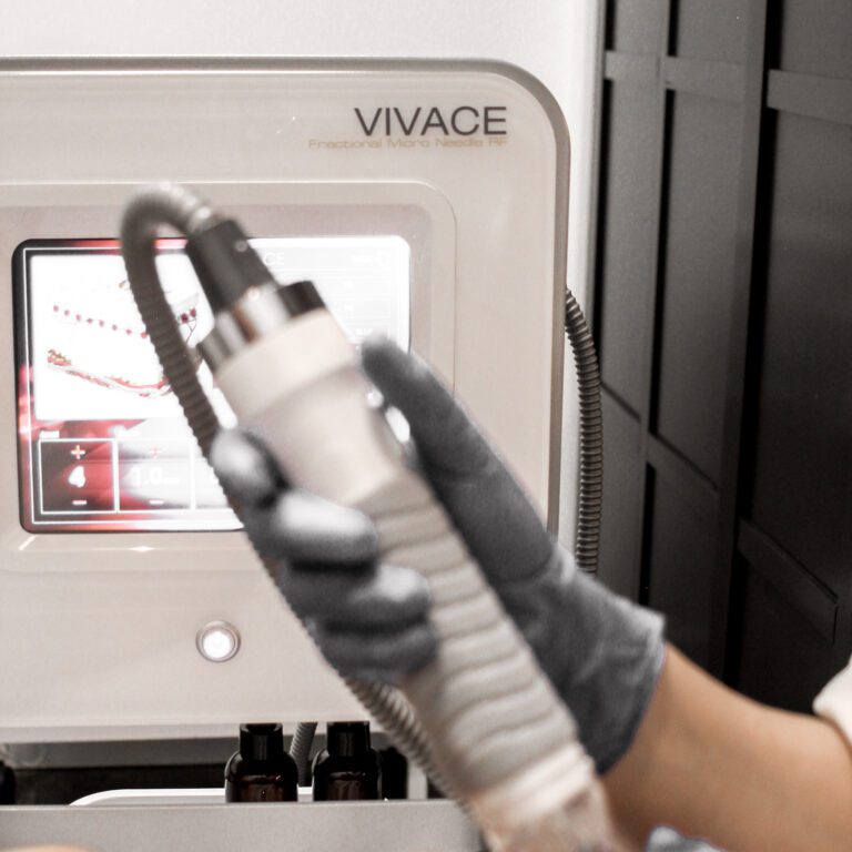 Vivace RF Microneedling - Elan Skin and Laser