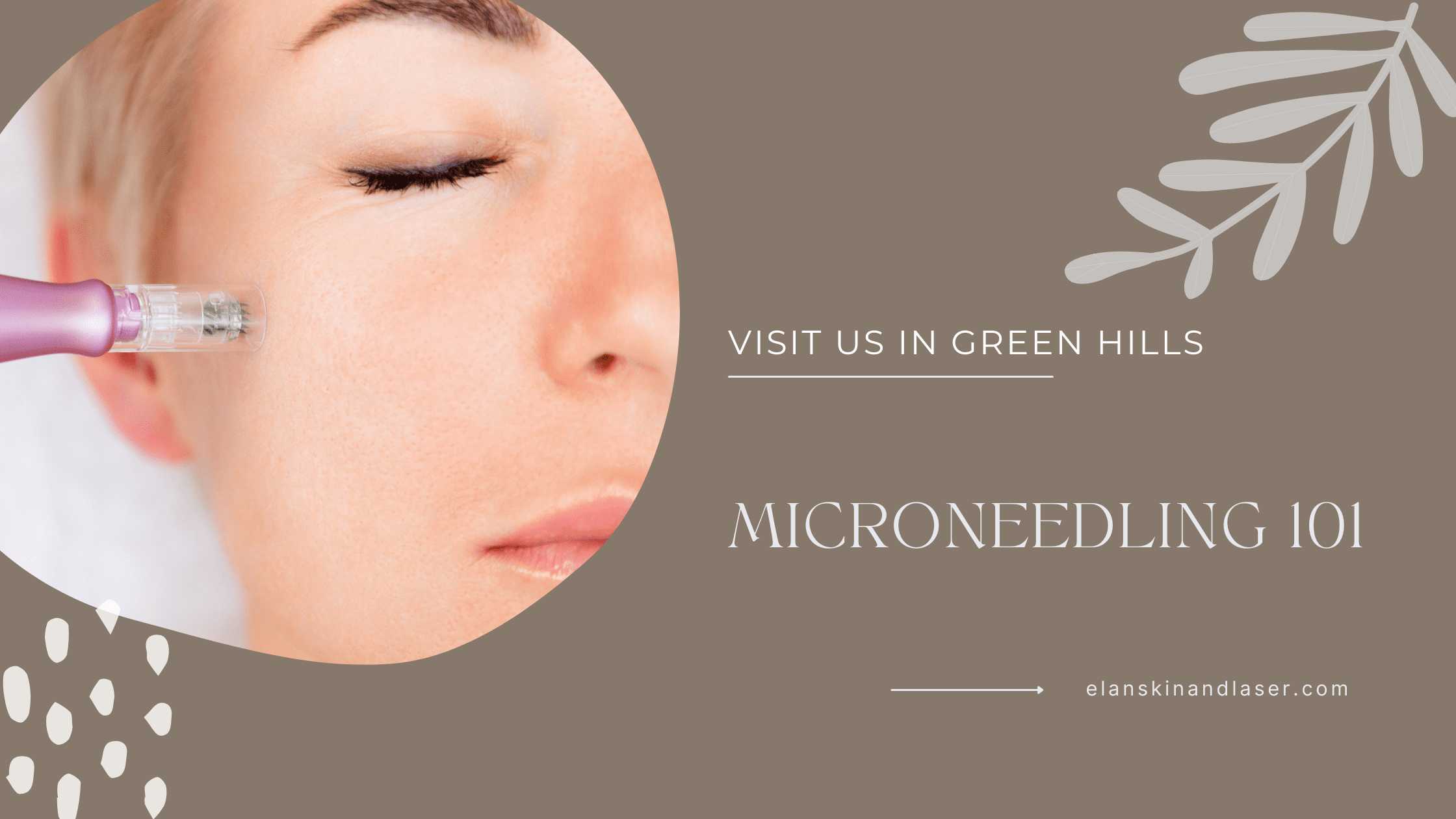 Microneedling 101: How This Treatment Transforms Skin for a Youthful Glow - Elan Skin and Laser
