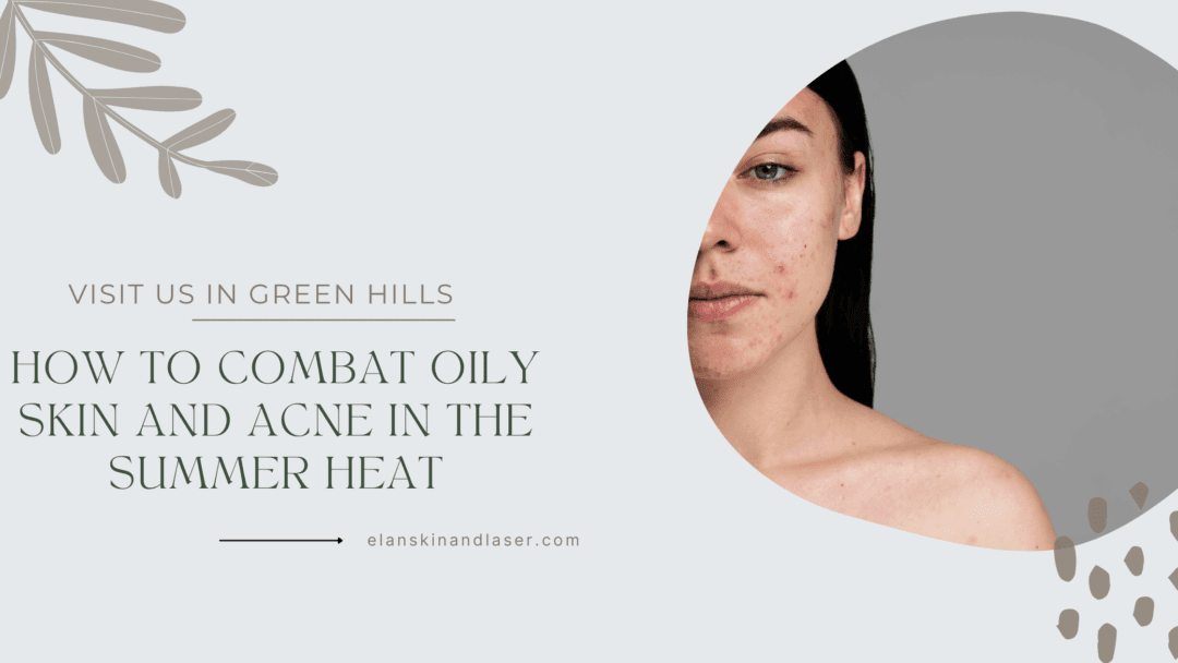 How to Combat Oily Skin and Acne in the Summer Heat - Elan Skin and Laser