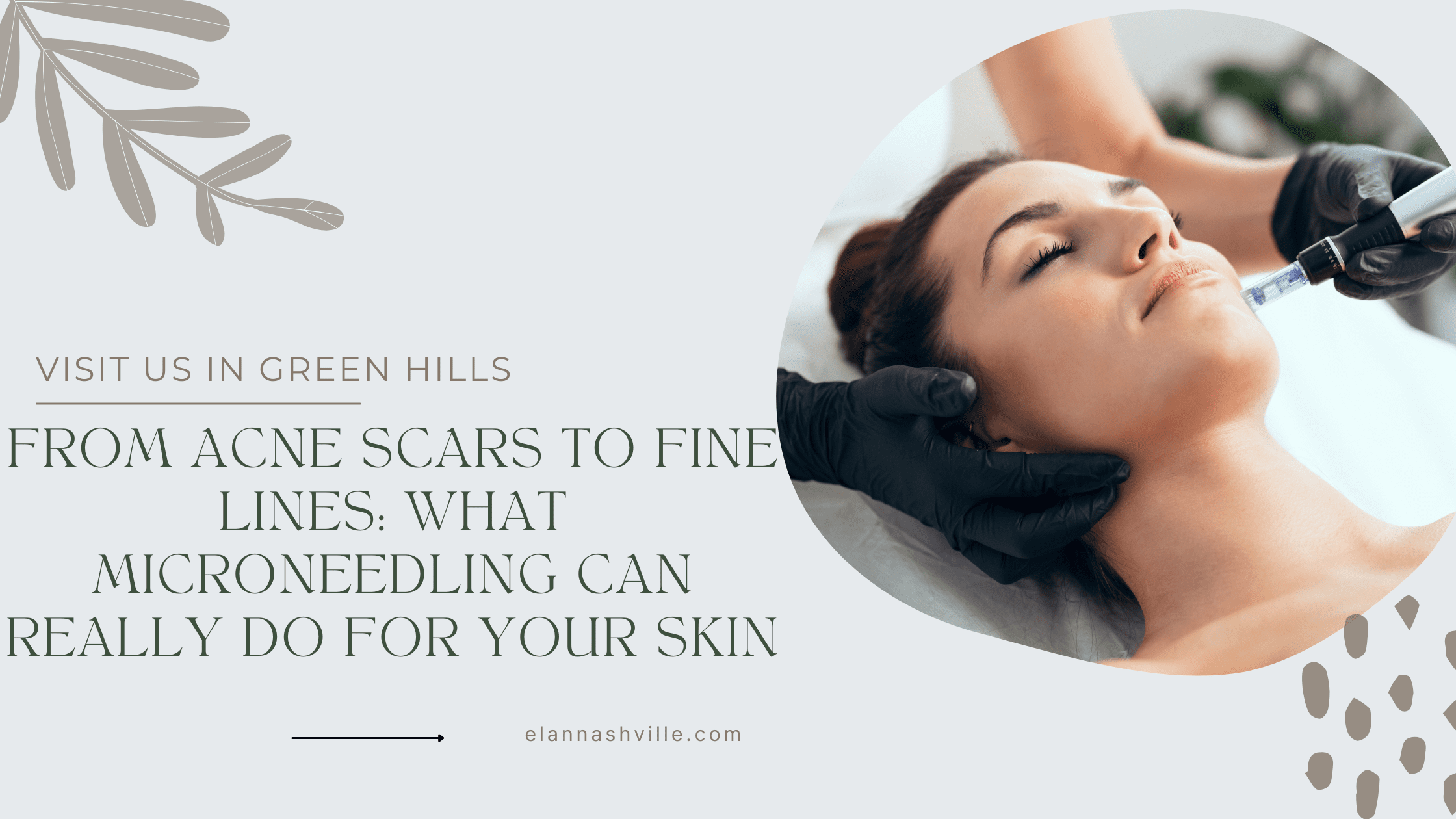 From Acne Scars to Fine Lines: What Microneedling Can Really Do for ...